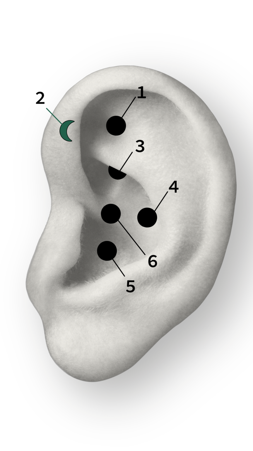 How To Apply Ear Seeds - Claire Watkins Acupuncture